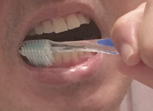 How to brush your teeth properly - Orthosmile Orthodontics